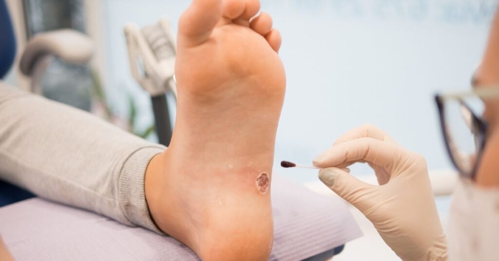 What causes dry feet? - Advance Foot Clinic Podiatry