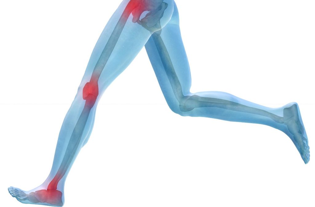 Custom Orthotics - Advance Foot Clinic Podiatry