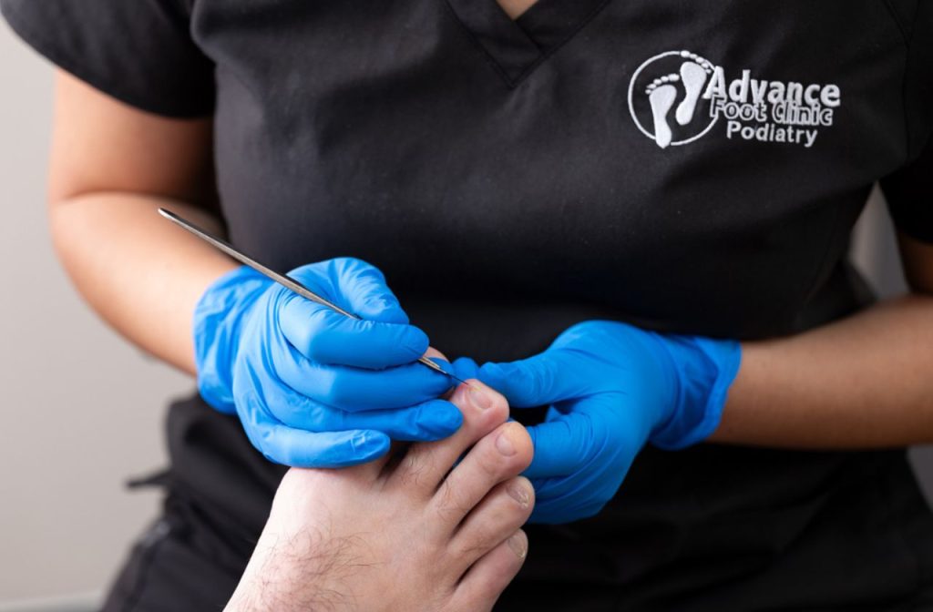 Our Podiatry Treatments - Advance Foot Clinic Podiatry