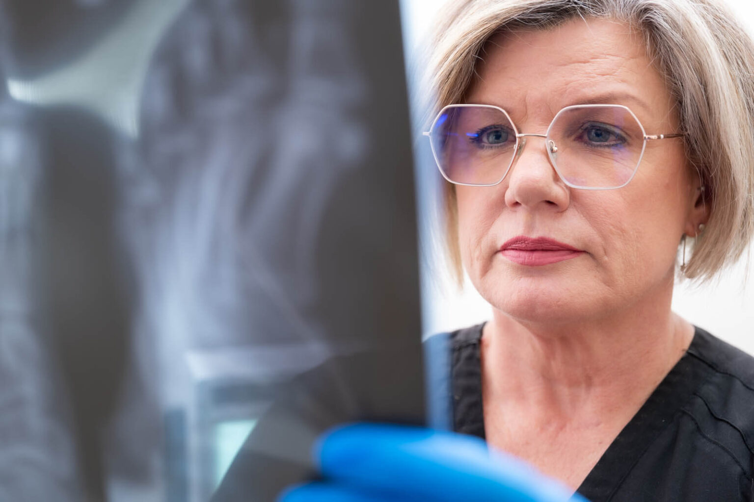 Moon Boots for Injury Recovery - Advance Foot Clinic Podiatry