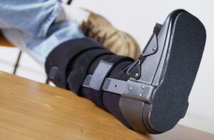 Moon Boots for Injury Recovery - Advance Foot Clinic Podiatry