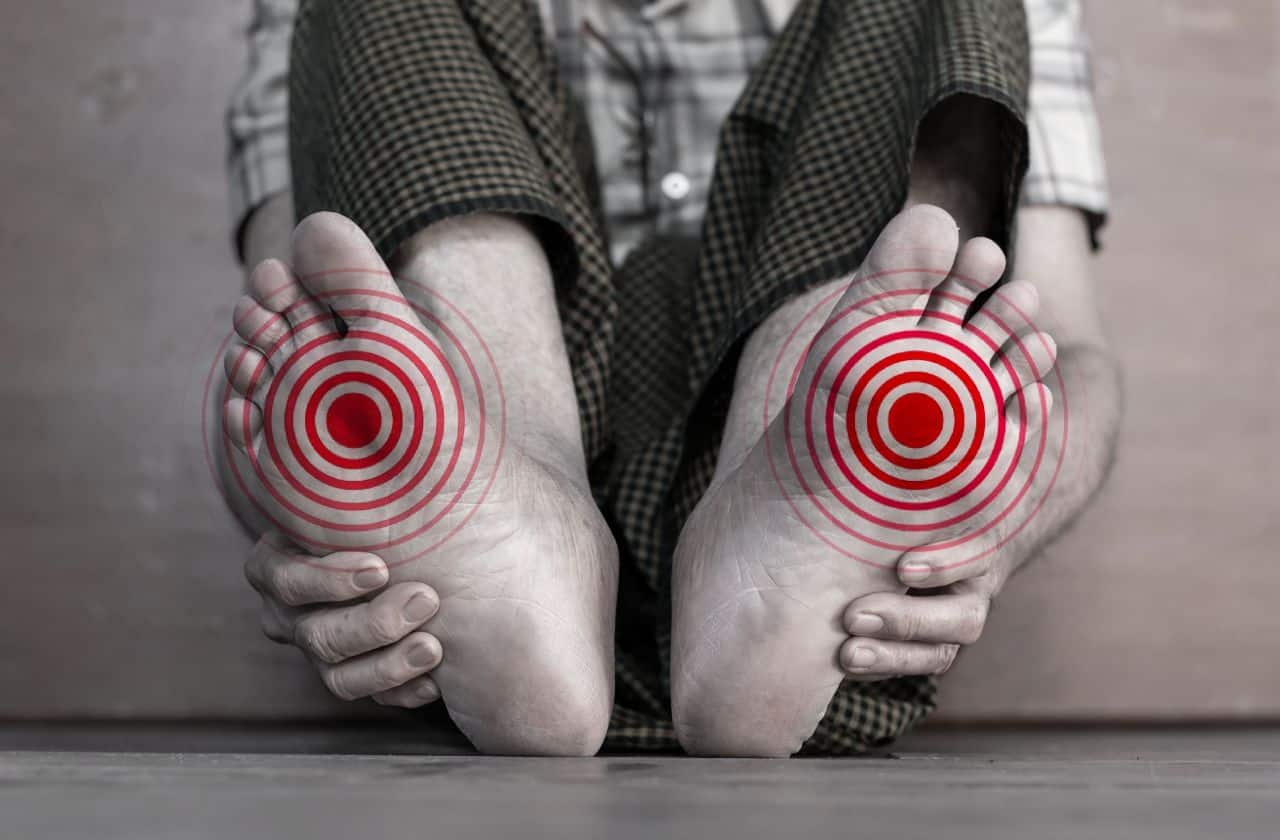 Cracked Feet - Advance Foot Clinic Podiatry