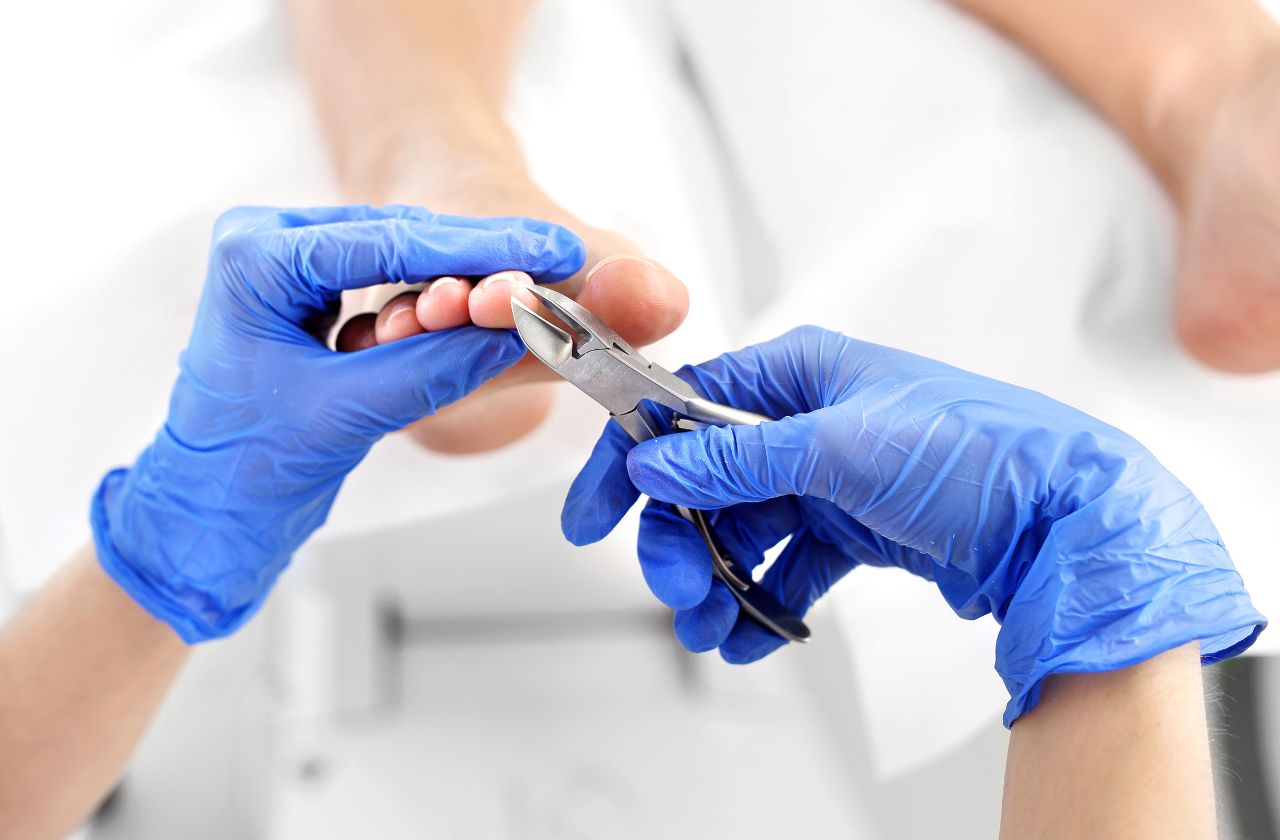 Should You Dig Out an Ingrown Nail? - Advance Foot Clinic