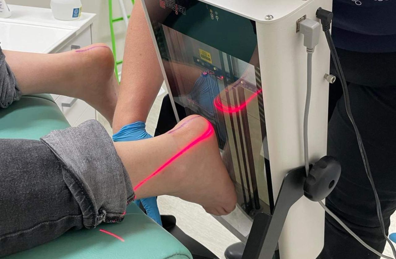 Custom Orthotics - Advance Foot Clinic Podiatry